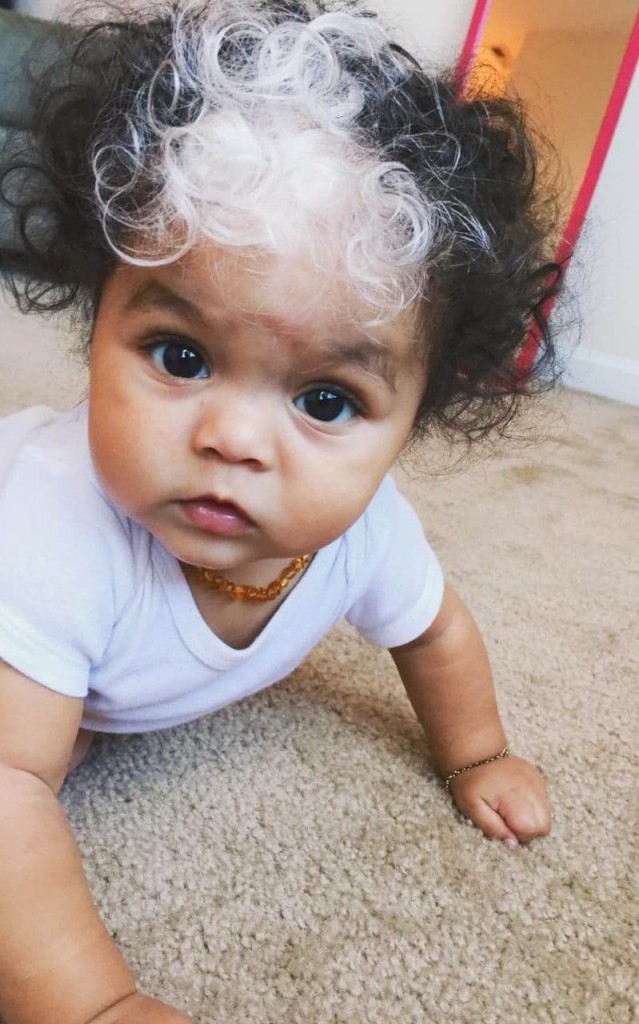 Baby Born With White Hair Is One Of The Rarest And Most Beautiful ...