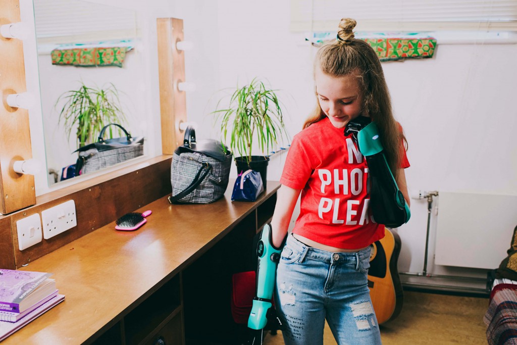 Open Bionics Hero Arm is a 3D Printed Bionic Arm That Will Give Every ...
