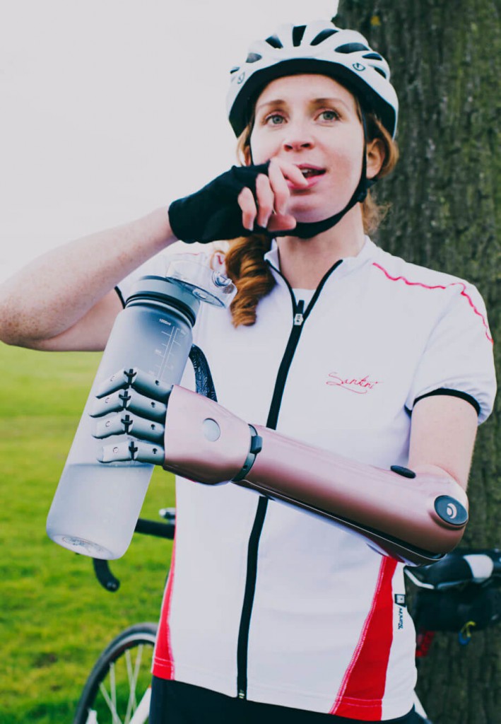 Open Bionics Hero Arm is a 3D Printed Bionic Arm That Will Give Every ...